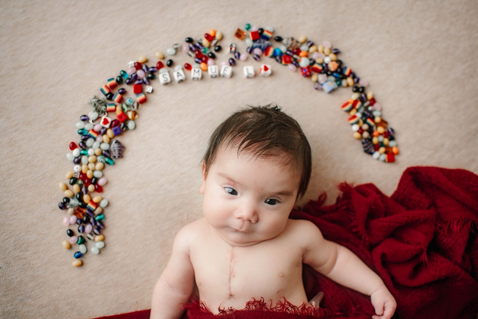 Samuel's heart full of hope: Overcoming congenital heart defects at Children's Hospital New Orleans