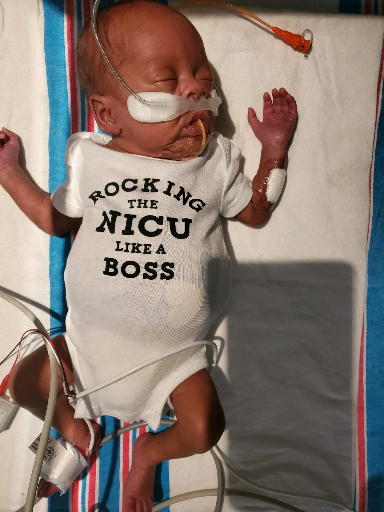 Born at Just 24 Weeks, Baby Aiden Continues to Overcome Challenges of ...