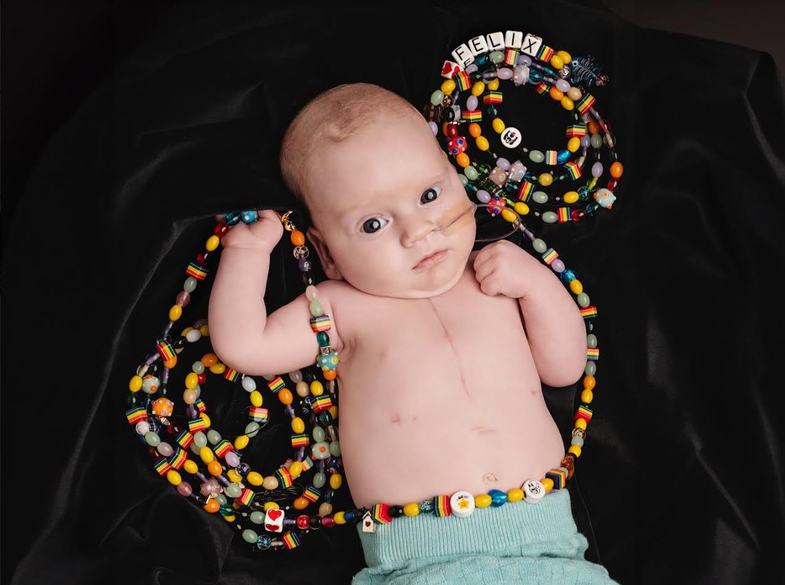 Healing a tiny heart: baby Felix’s journey with Truncus Arteriosus